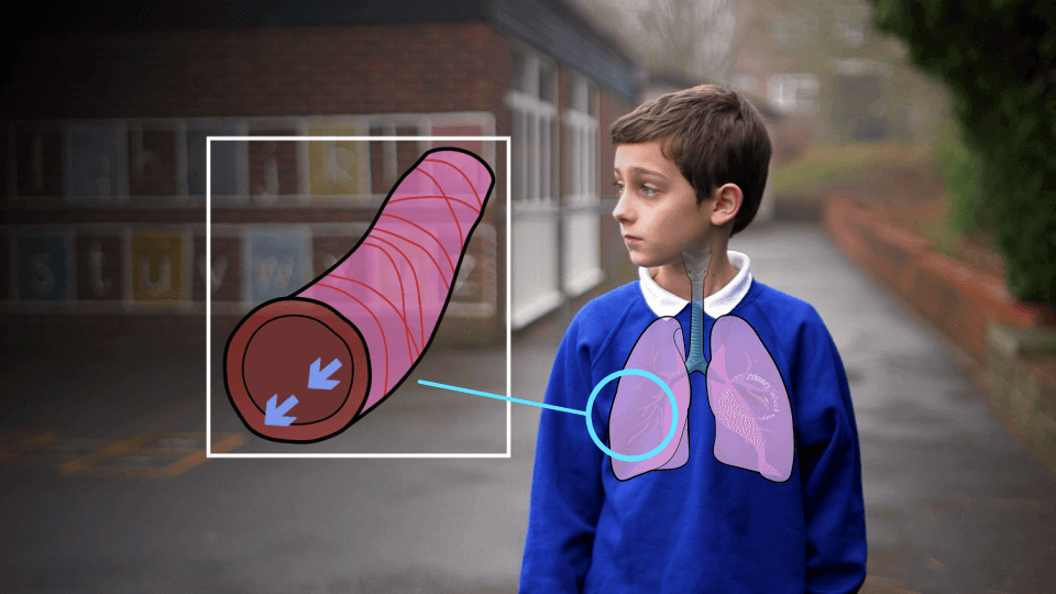 Asthma Training for Schools & Carers - Key Group Services